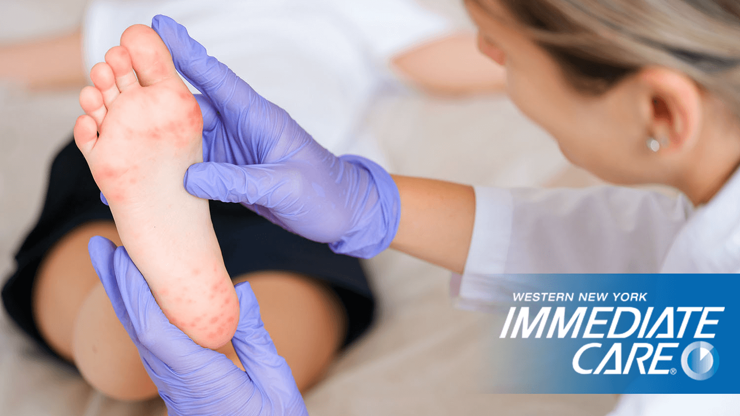Hand, Foot, and Mouth | Doctor's Orders | WNY Immediate Care