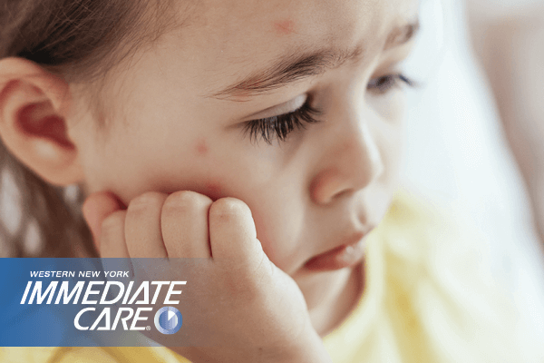 Understanding Measles